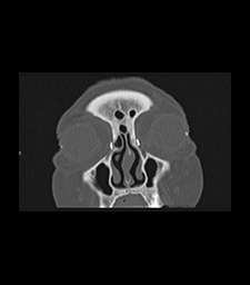 Dacryoscanner | Centre d'imagerie Médicale RISF